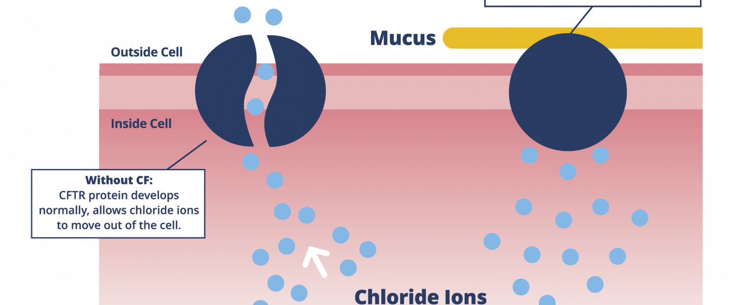 Why You Should Get Your Genes Retested » Cystic Fibrosis NZ